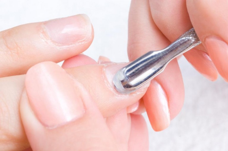 Zanoktice - Zašto nastaju, prevencija i lečenje | Nokti | Lepotica.rs