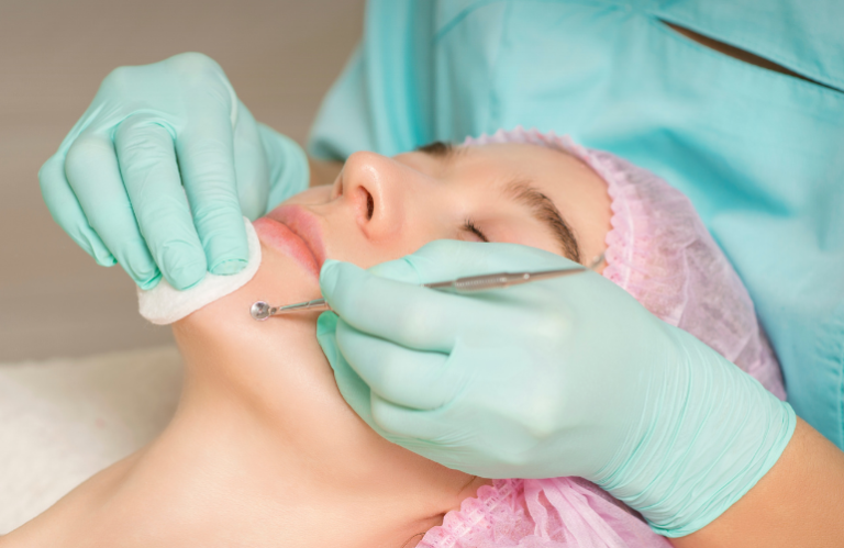 Kako se koristi ekstraktor za mitisere? | Lepotica.rs