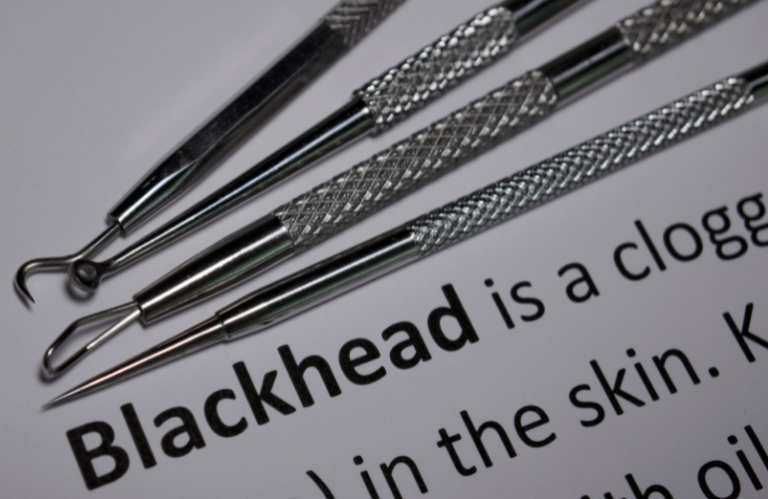 Kako se koristi ekstraktor za mitisere? | Lepotica.rs